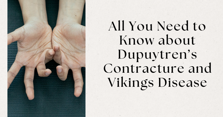 All You Need to Know about Dupuytren’s Contracture and Vikings Disease ...