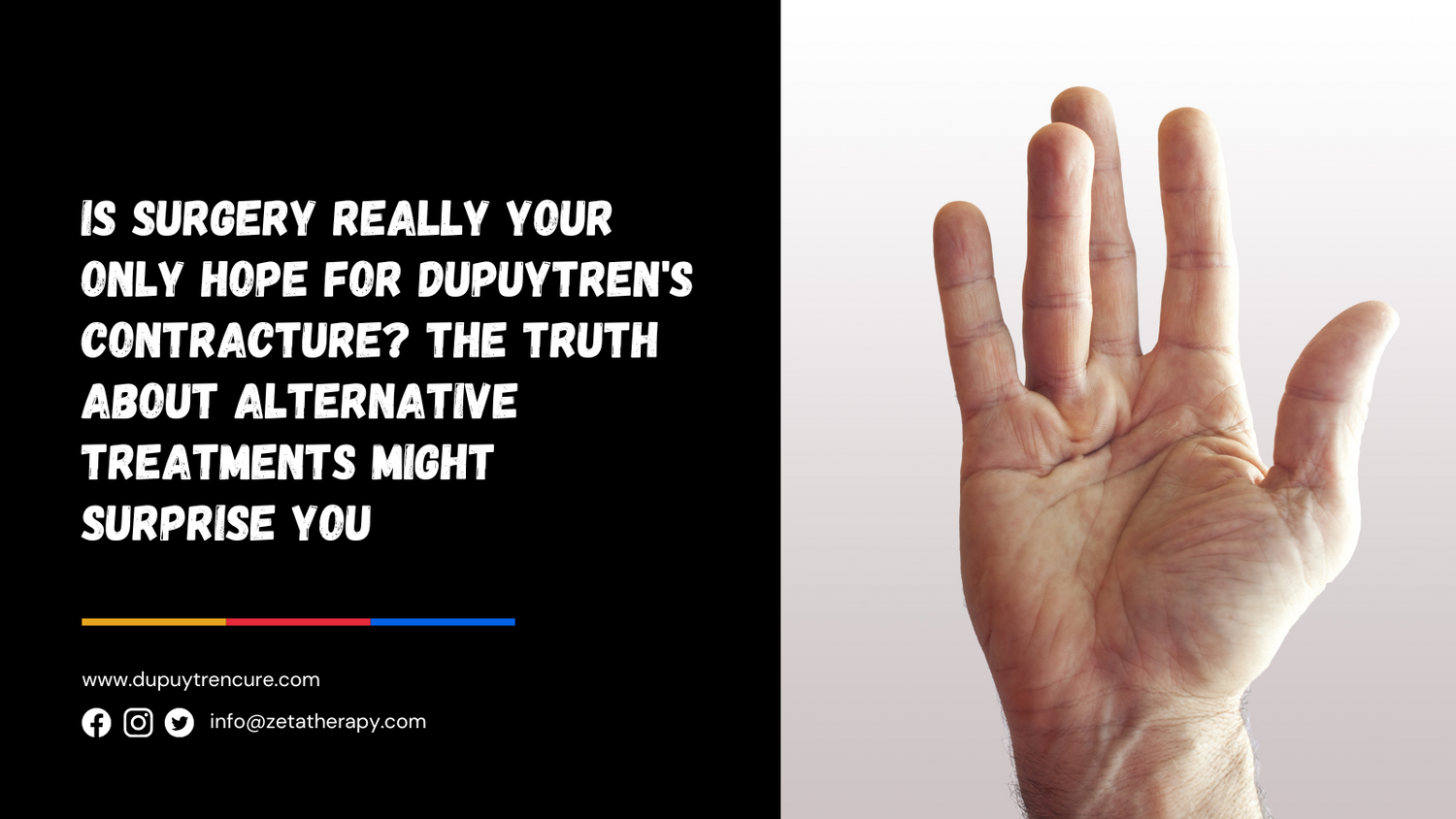 Is Surgery Really Your Only Hope for Dupuytren's Contracture? The Trut ...