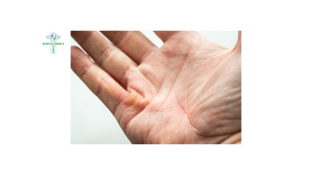 What is the MacCrimmons Curse? – Dupuy Trencure